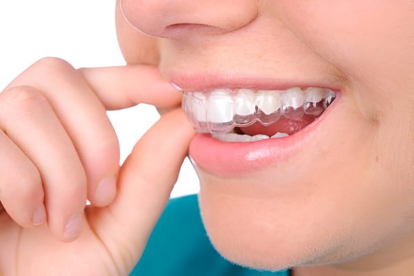 Subtle Signs Indicating You Need Orthodontic Intervention - BE Healthly